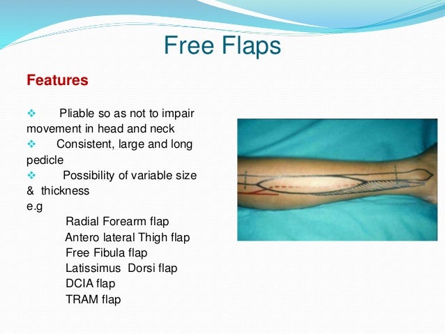 Reconstruction in head and neck surgeries