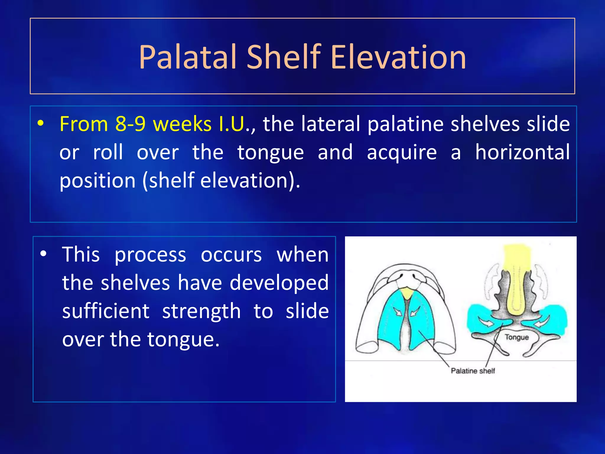 Reconstruction of cleft lip and palate defect | PPTX