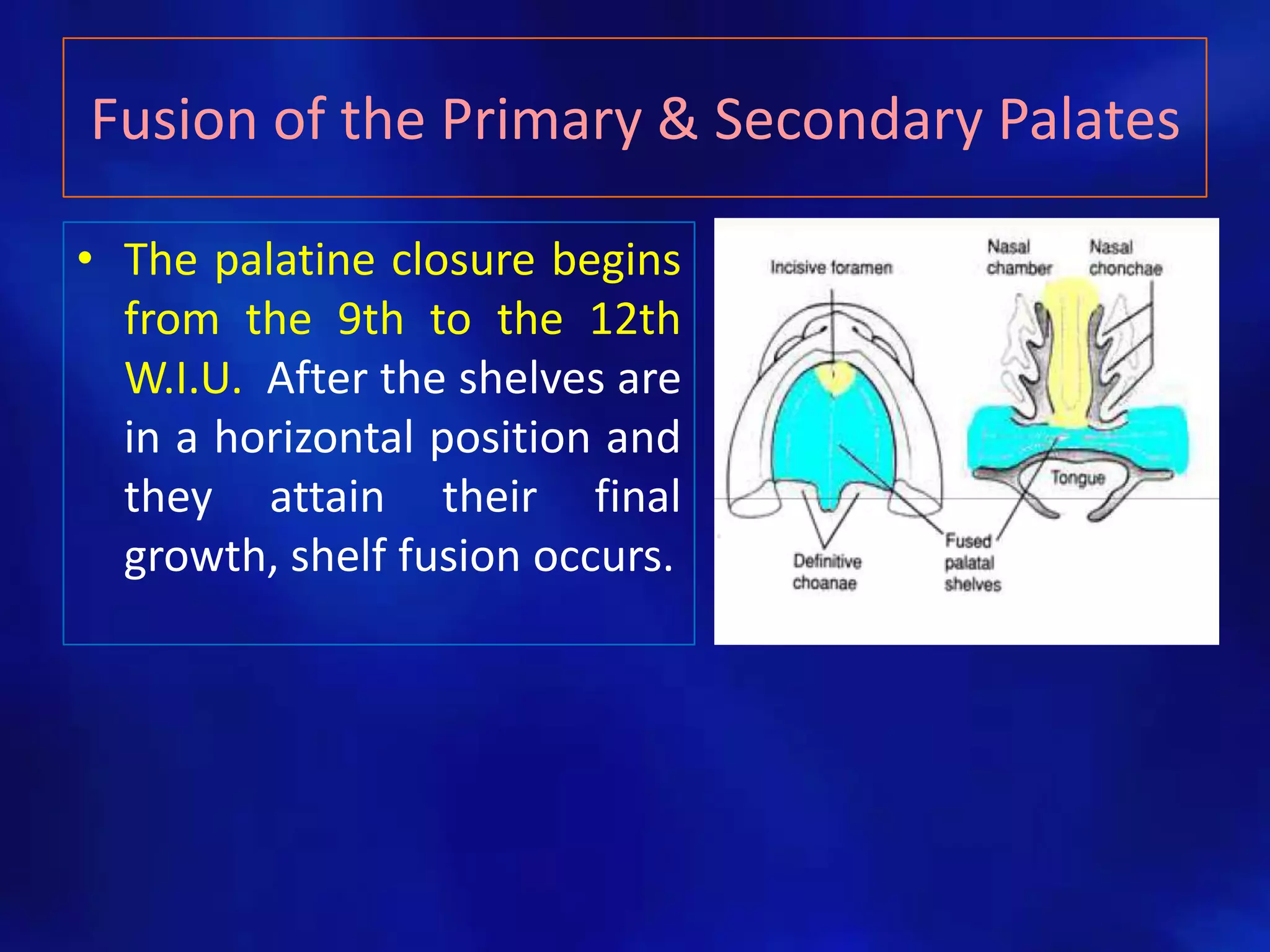 Reconstruction of cleft lip and palate defect | PPTX