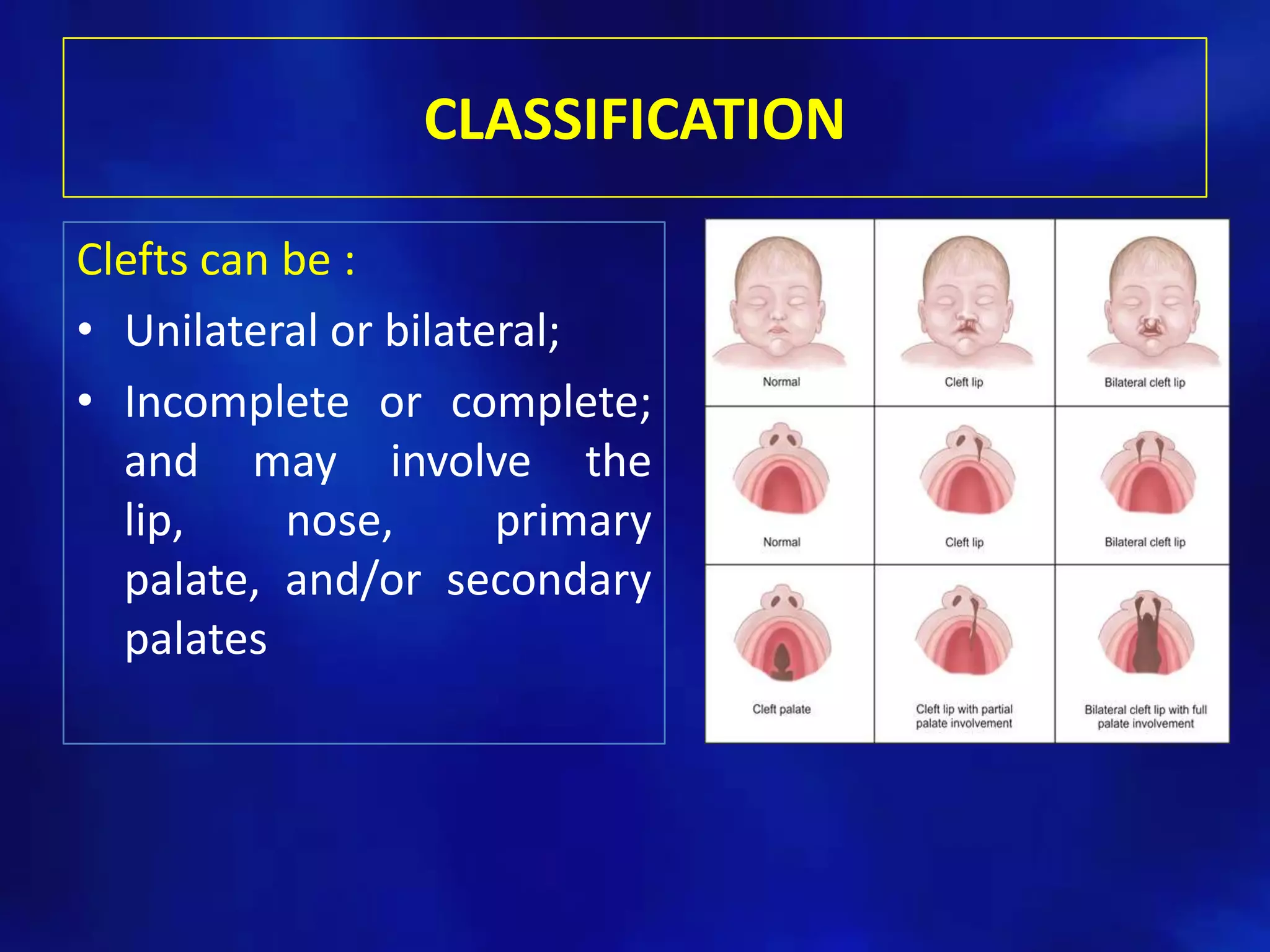 Reconstruction of cleft lip and palate defect | PPTX