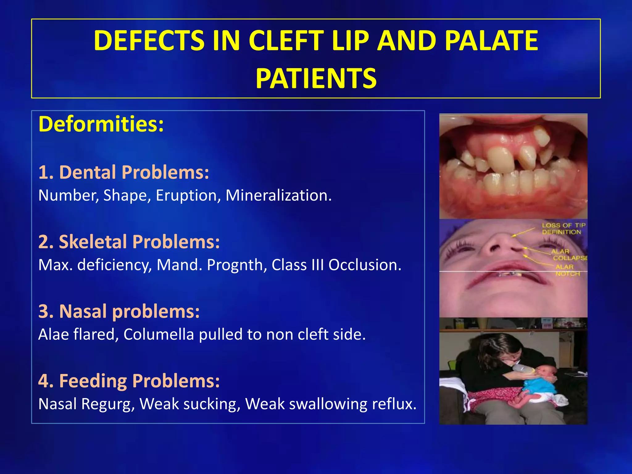 Reconstruction of cleft lip and palate defect | PPT
