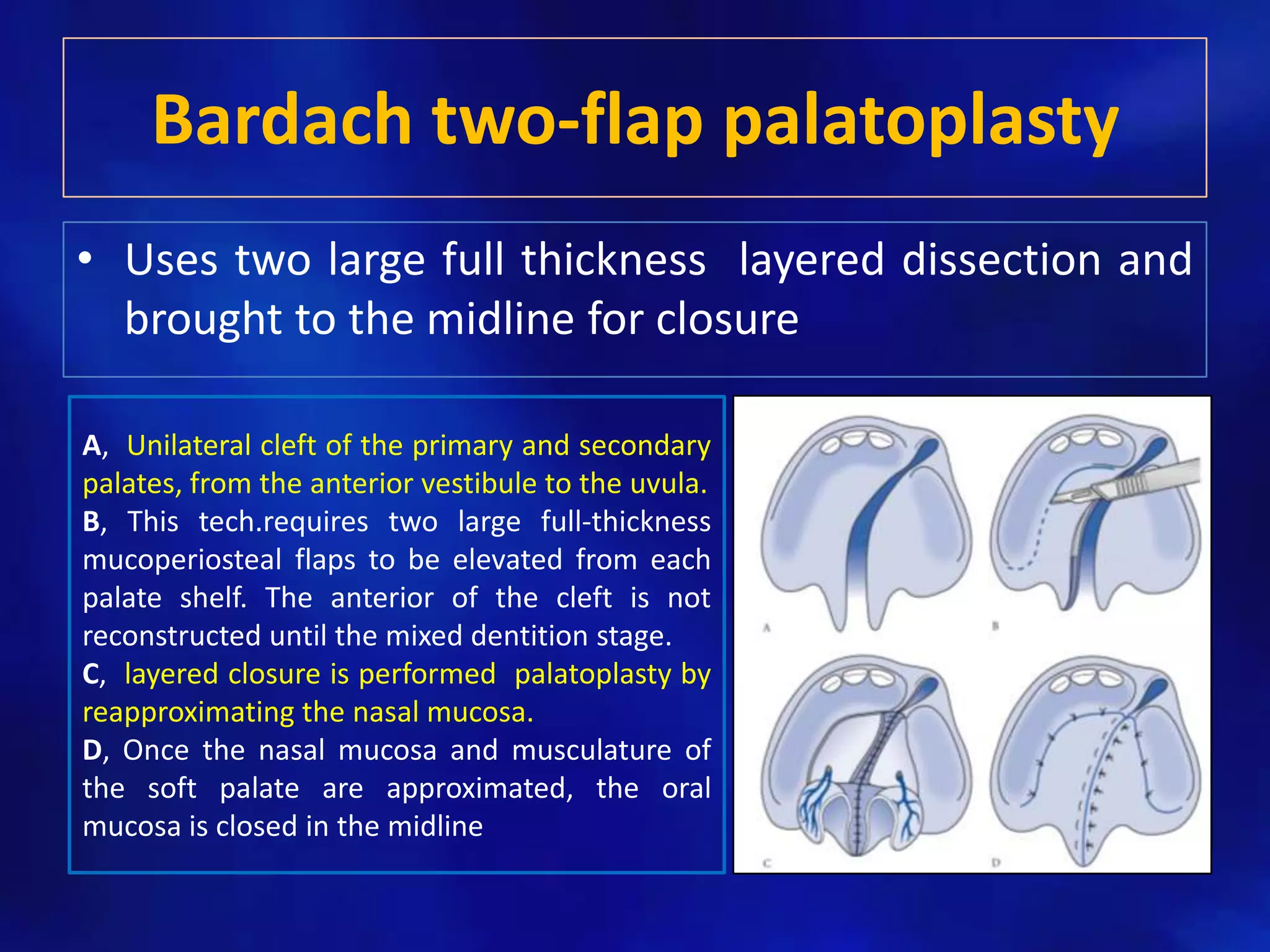 Reconstruction of cleft lip and palate defect | PPTX