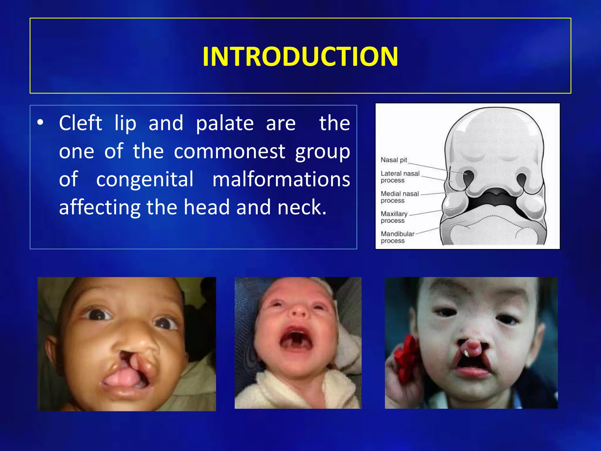 Reconstruction of cleft lip and palate defect | PPTX