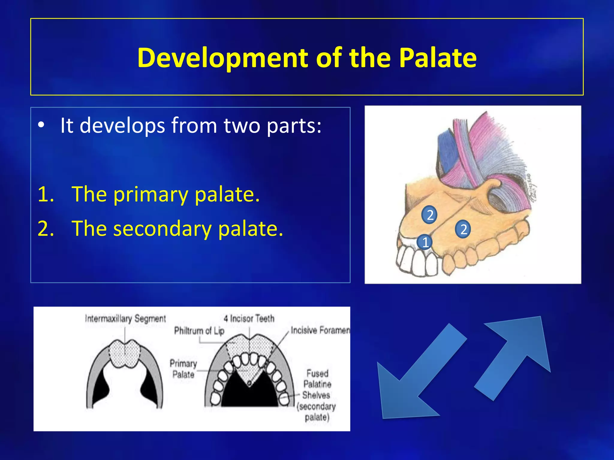 Reconstruction of cleft lip and palate defect | PPTX
