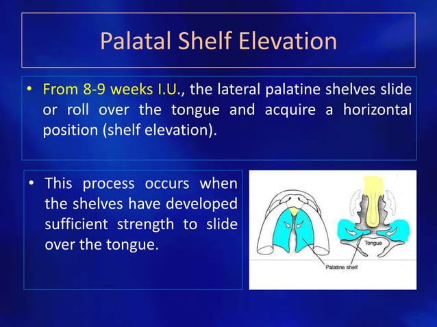 Reconstruction of cleft lip and palate defect | PPTX | Ear, Nose and Throat Conditions ...