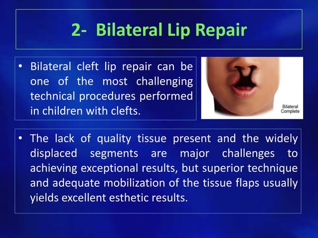 Reconstruction of cleft lip and palate defect | PPTX | Ear, Nose and Throat Conditions ...