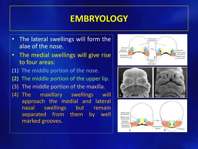 Reconstruction of cleft lip and palate defect | PPTX | Ear, Nose and Throat Conditions ...