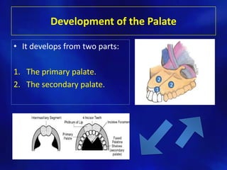 Reconstruction of cleft lip and palate defect | PPTX