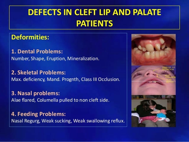 Reconstruction of cleft lip and palate defect