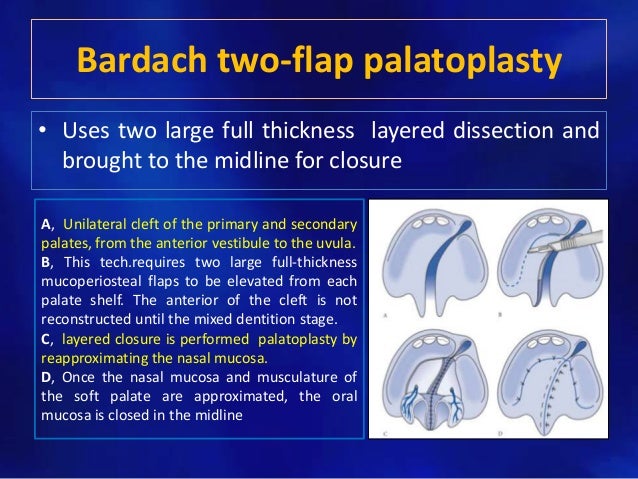 Cleft Palate Repair Techniques