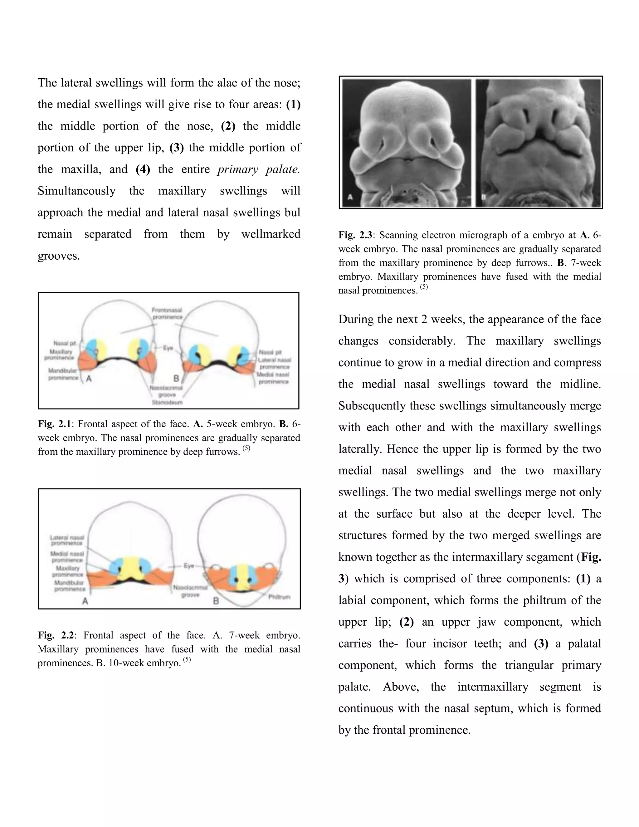 Article of Reconstruction of cleft lip and palate defect | PDF