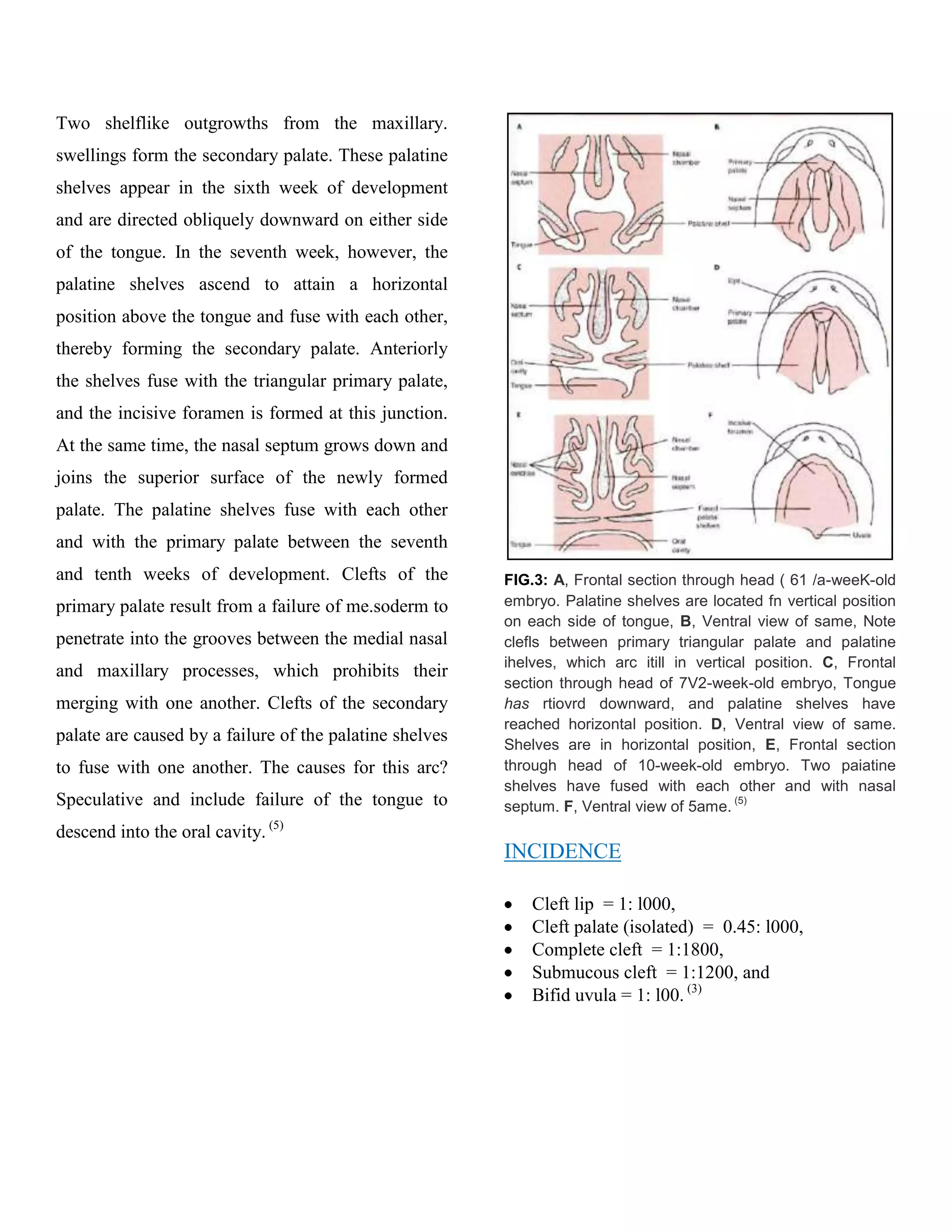 Article of Reconstruction of cleft lip and palate defect | PDF