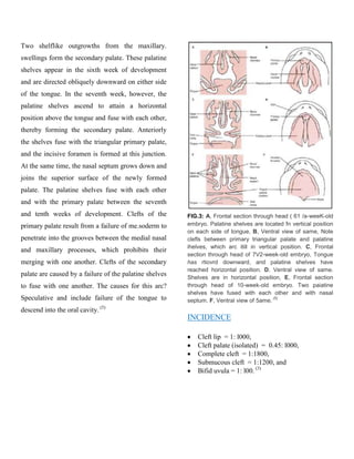 Article of Reconstruction of cleft lip and palate defect | PDF