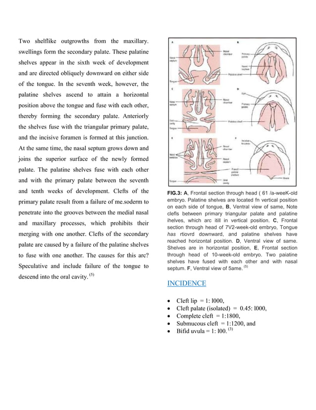 Article of Reconstruction of cleft lip and palate defect | PDF