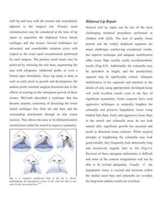 Article of Reconstruction of cleft lip and palate defect | PDF