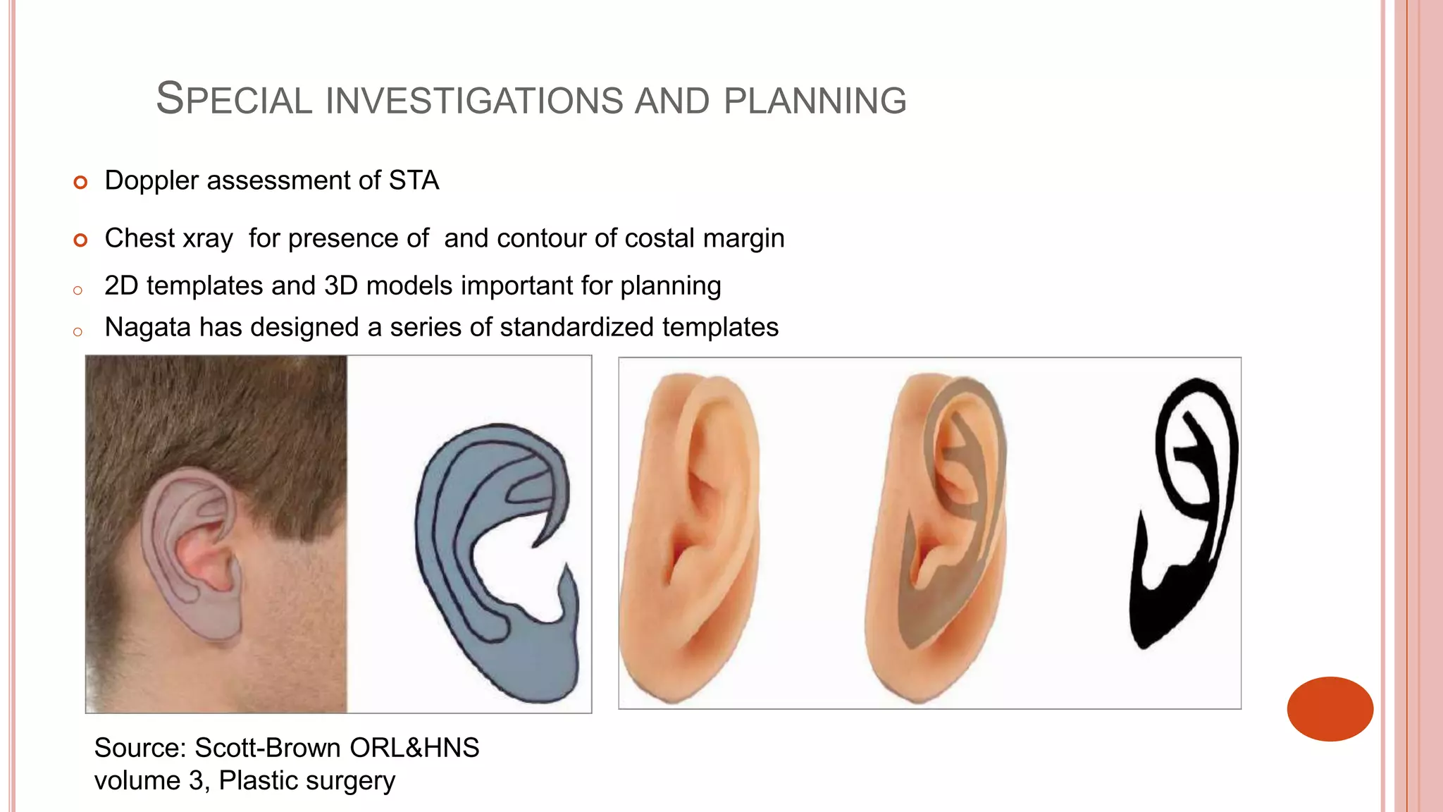 Reconstruction of ear | PPTX
