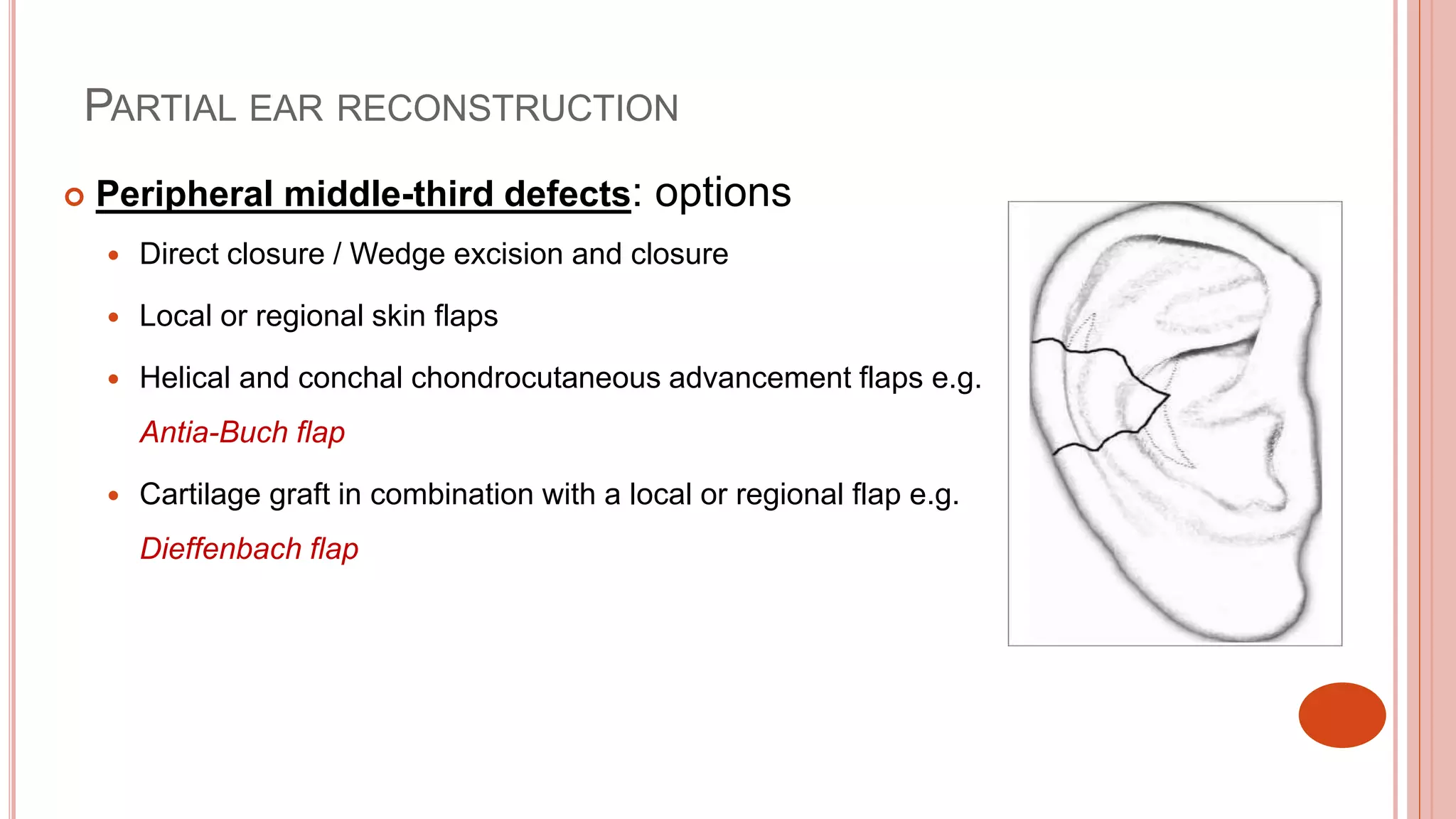 Reconstruction of ear | PPTX