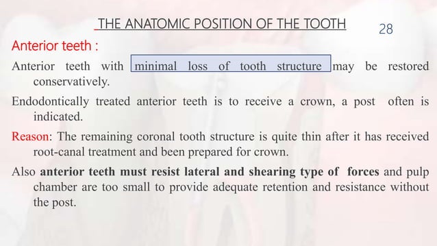 Reconstruction of endo tt teeth | PPT