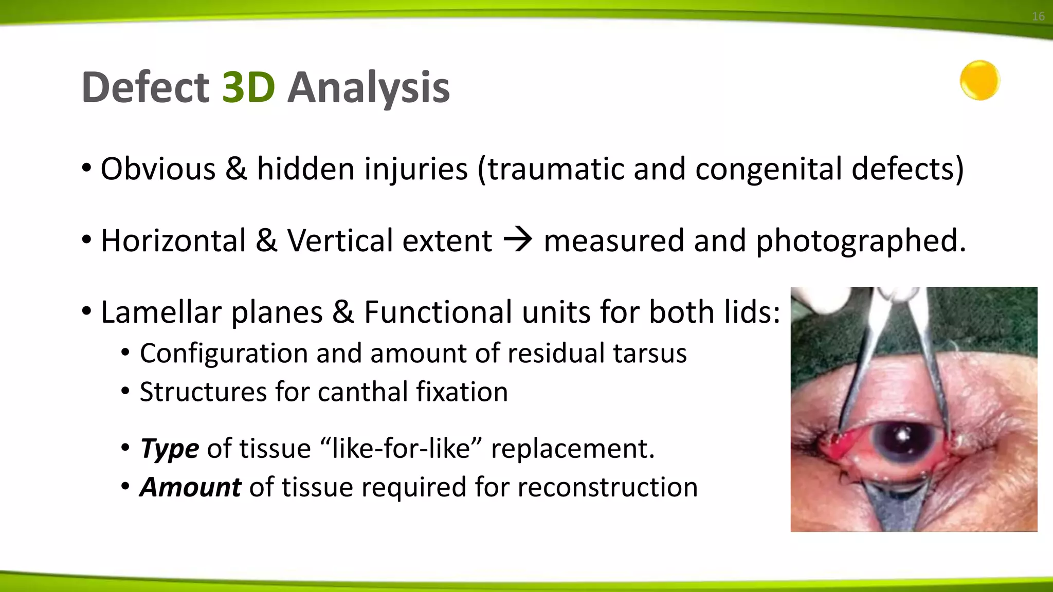 Reconstruction of eyelids defects | PPT