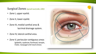 Reconstruction of eyelids defects | PPTX
