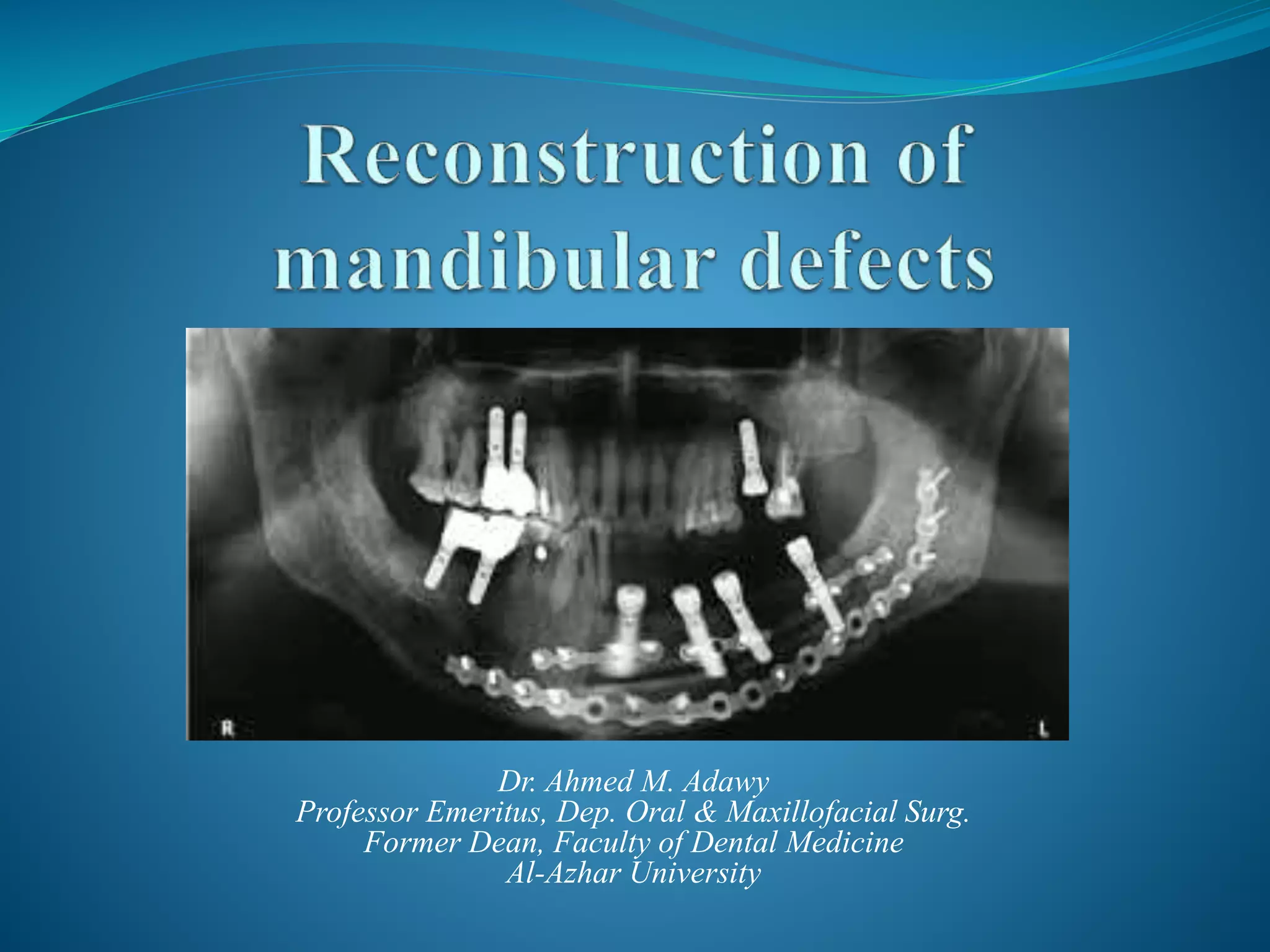 Reconstruction of mandibular defects | PPTX