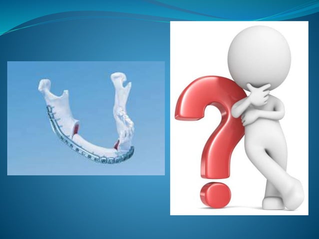 Reconstruction of mandibular defects | PPTX | Death, Injury, or ...