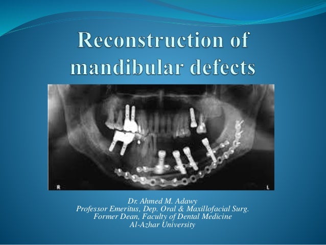 Reconstruction of mandibular defects
