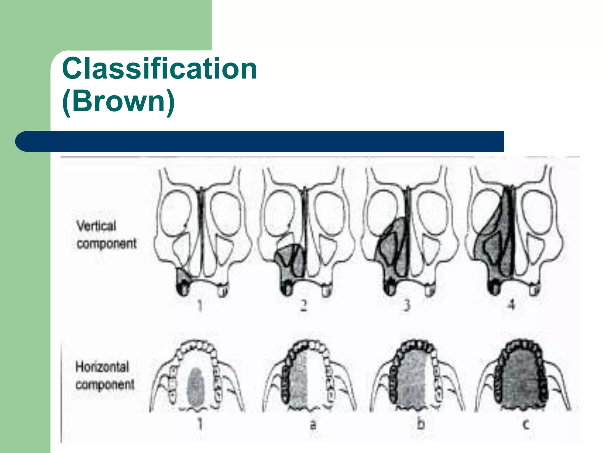 Reconstruction of maxilla | PPT