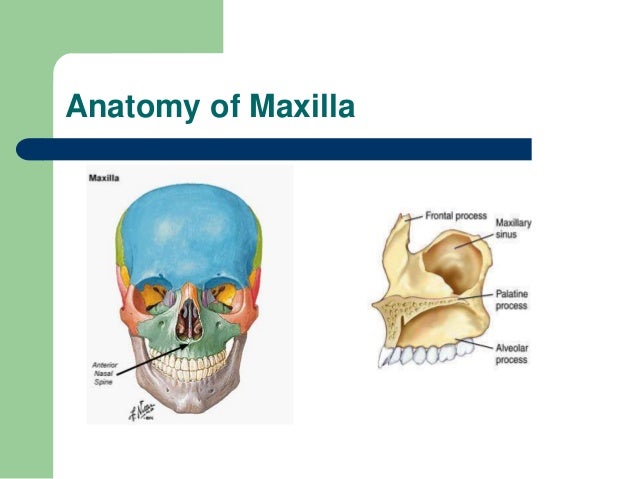 Reconstruction of maxilla