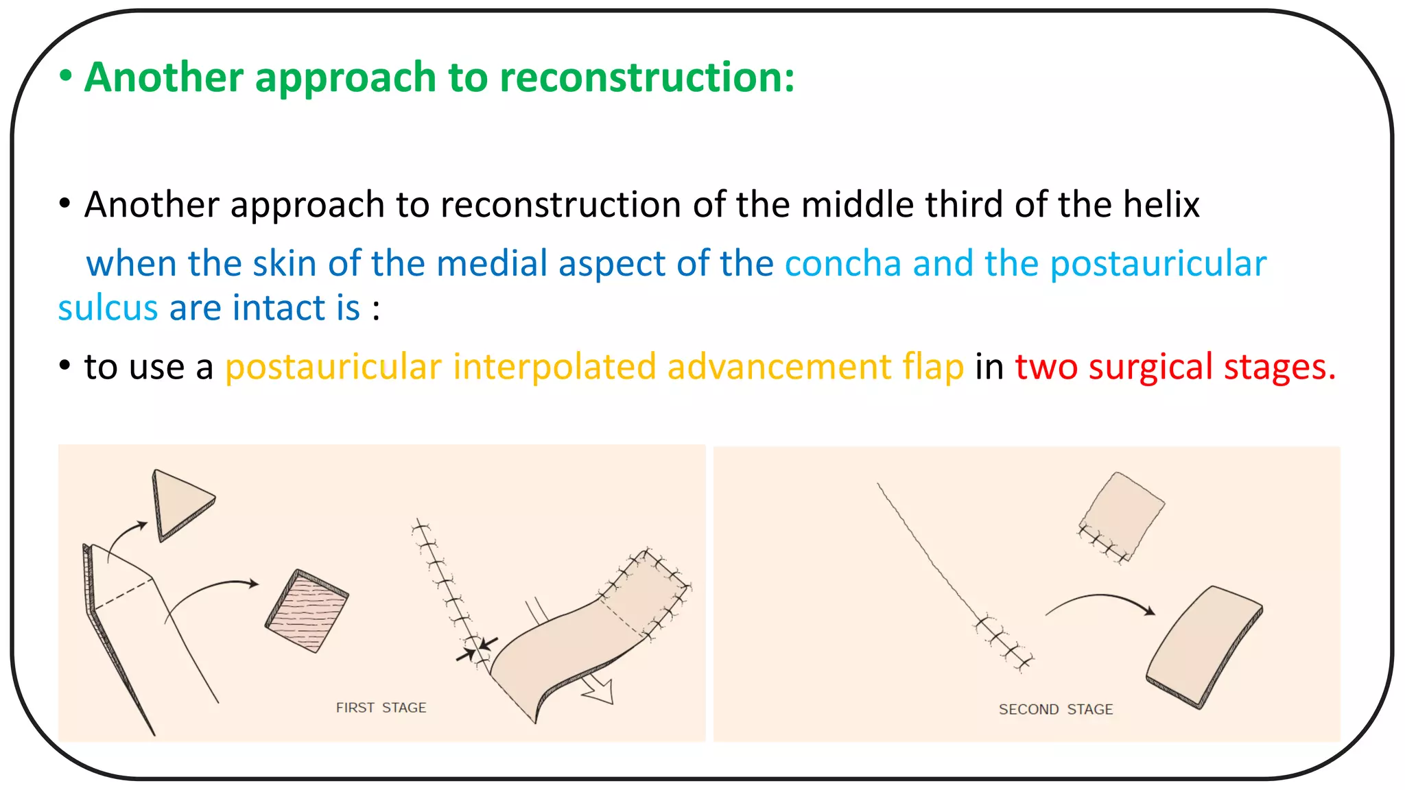 Reconstruction of the auricle Dr. M. Erami | PDF