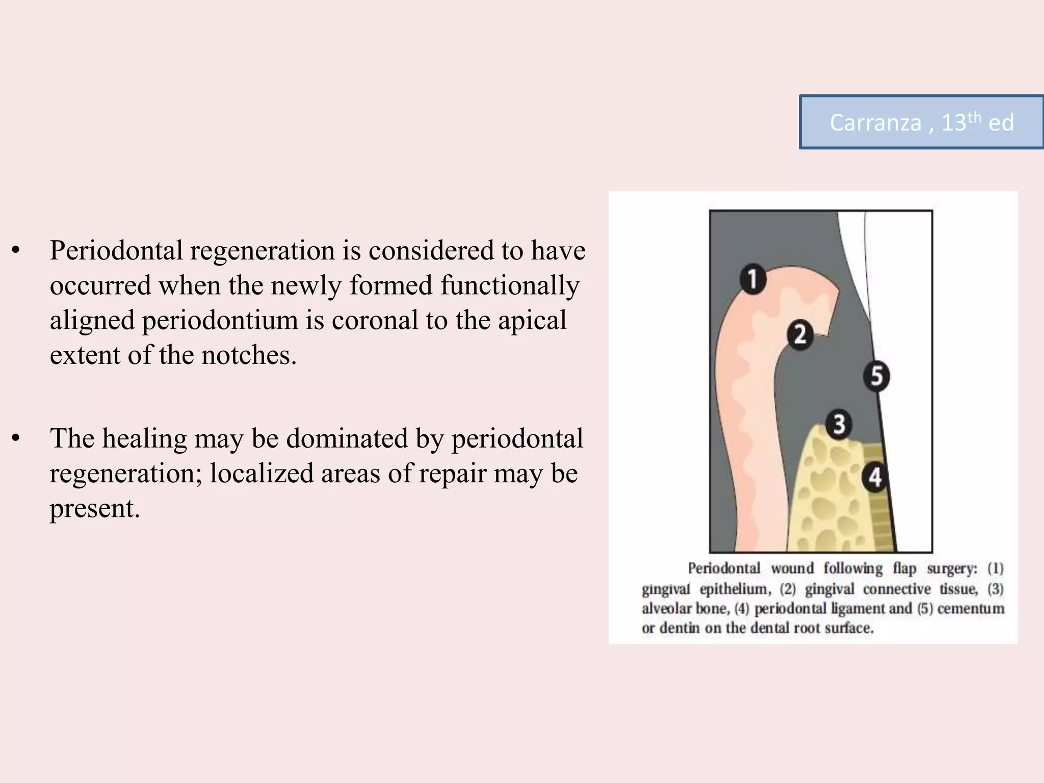Reconstructive periodontal surgery (part1+2+3) | PPTX
