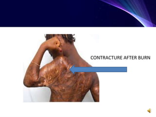 Reconstructive &plastic surgery | PPTX