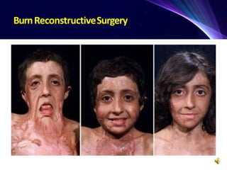Reconstructive &plastic surgery | PPTX