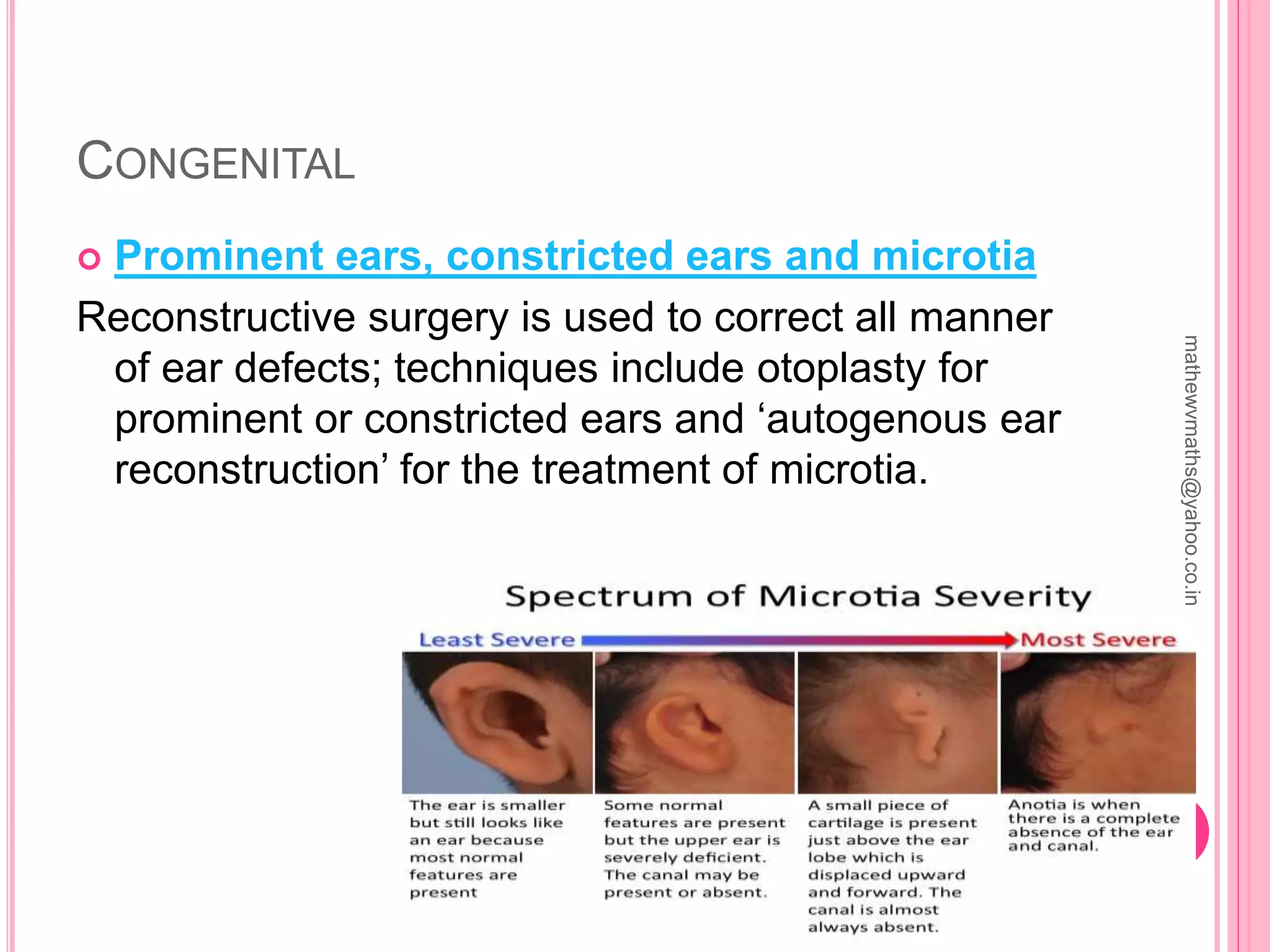 Reconstructive surgery | PPTX