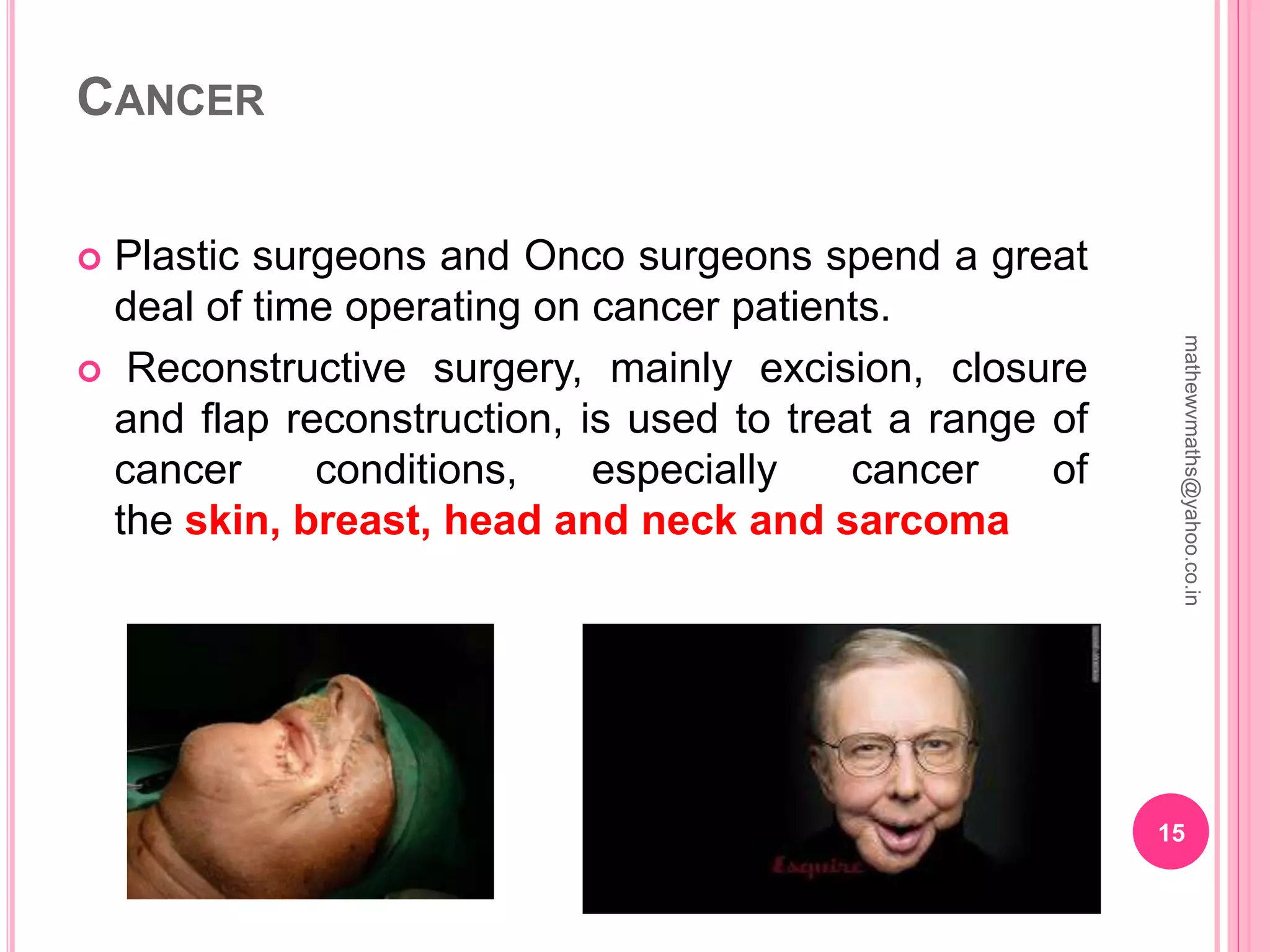 Reconstructive surgery | PPTX