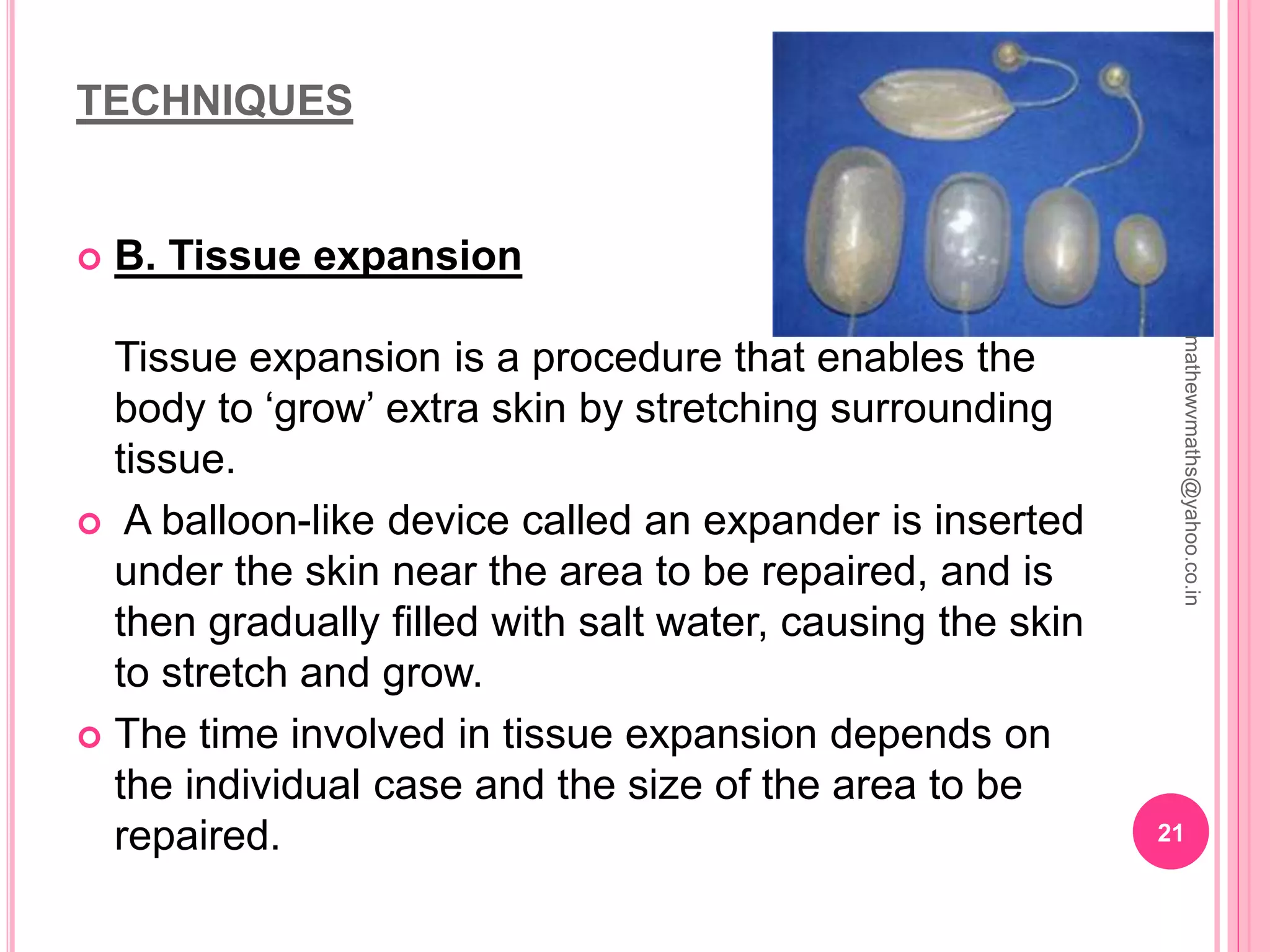 Reconstructive surgery | PPTX