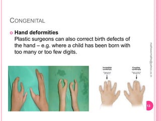 Reconstructive surgery | PPTX