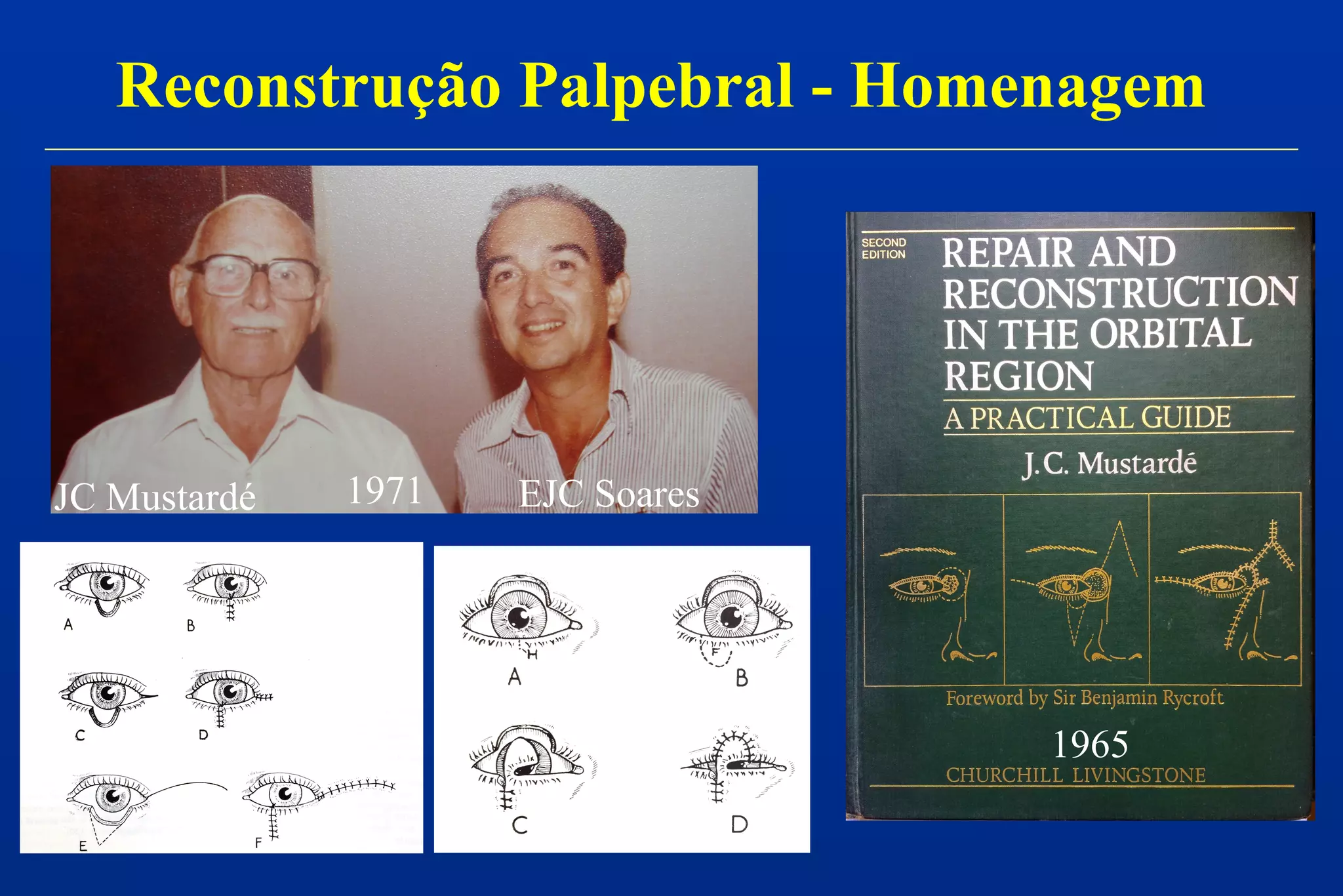 Reconstução palpebral com legendas | PPT