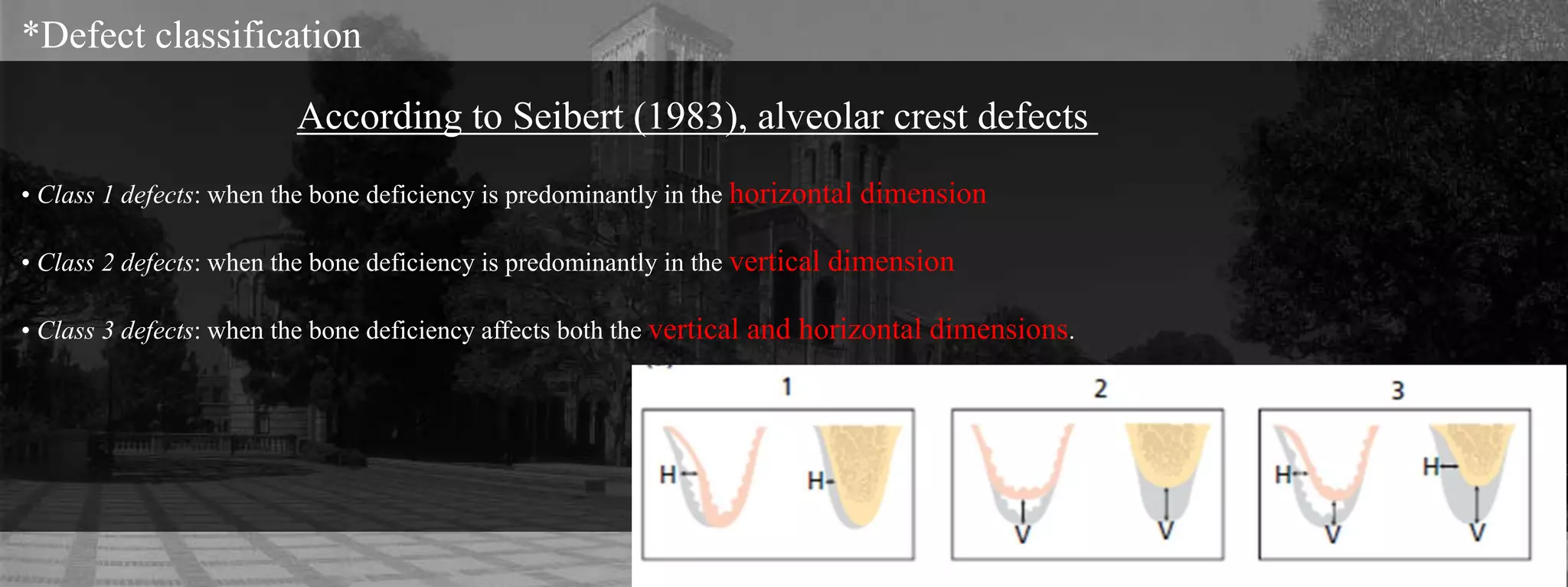 Ridge Augmentation Procedures | PPTX