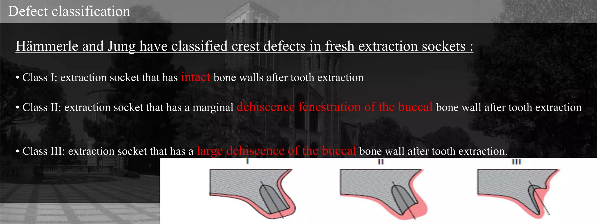 Ridge Augmentation Procedures | PPTX