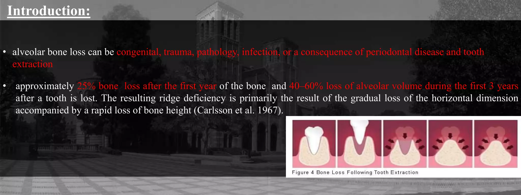 Ridge Augmentation Procedures | PPTX