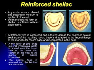 record_bases-.ppt | Oral care | Personal Care