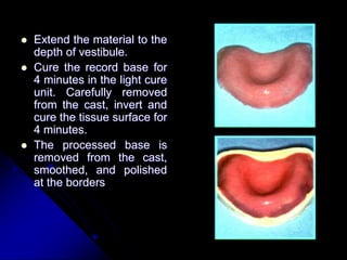 record_bases-.ppt | Oral care | Personal Care