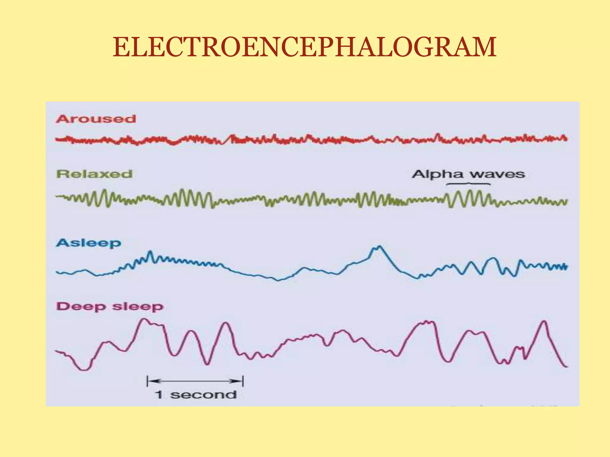 Recording brain activity | PPTX