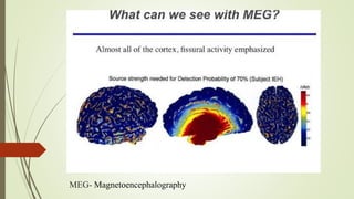 RECORDING BRAIN ACTIVITY.pdf