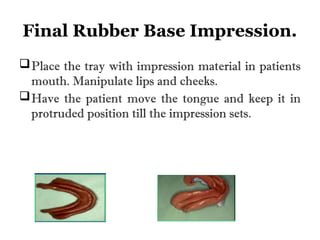 PROSTHODONTICS: RECORDING OF SECONDARY IMPRESSION.pptx
