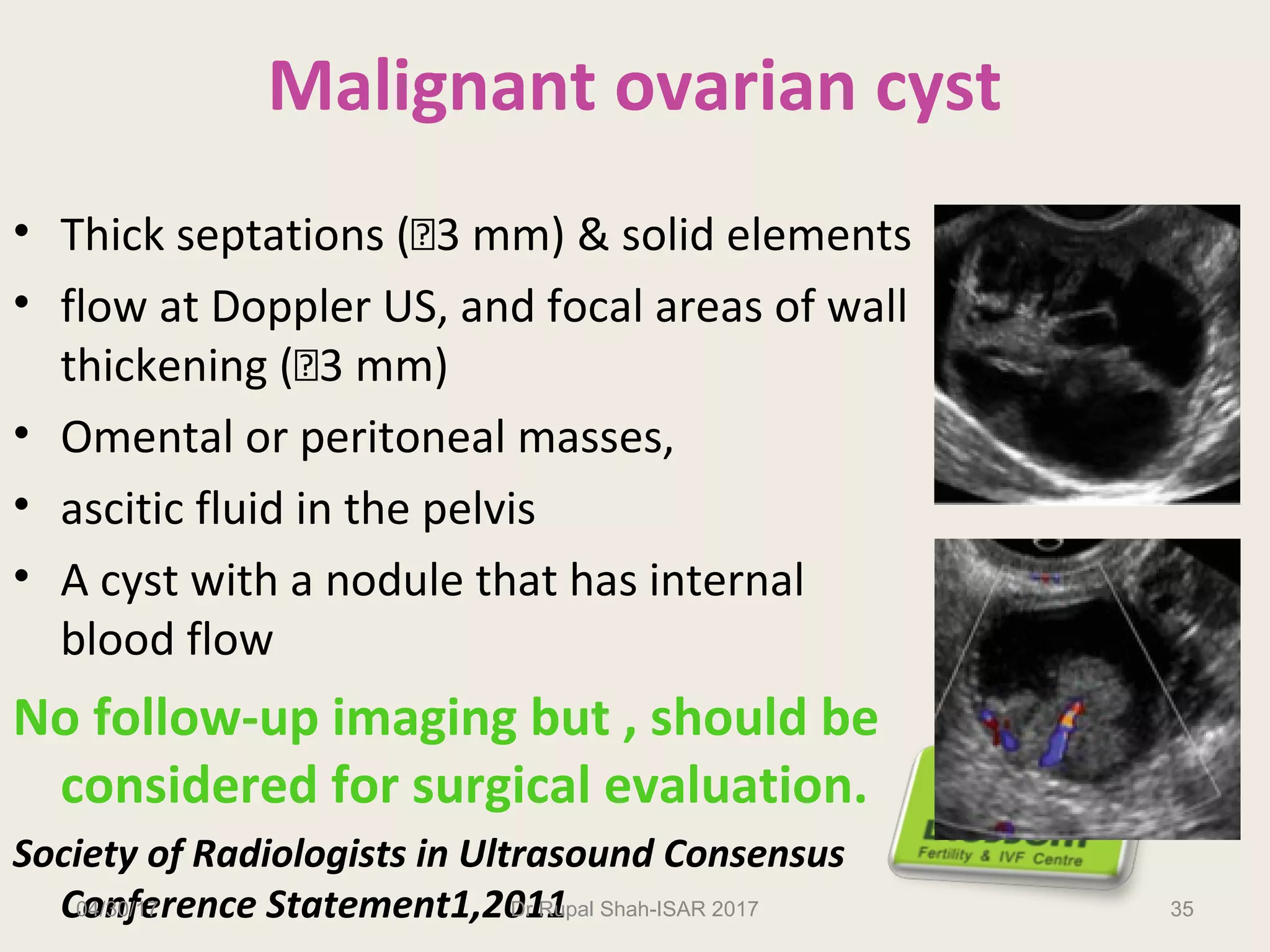 management of ovarian cysts other than endometriomas in infertility | PPT