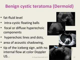 management of ovarian cysts other than endometriomas in infertility | PPT