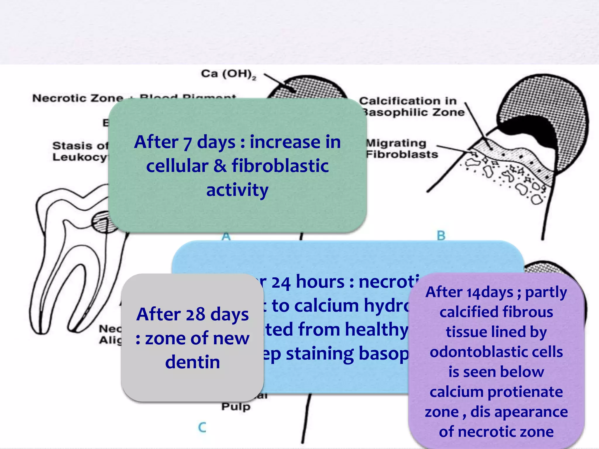pulp therapy in young permanent tooth | PPTX | Dental Health | Diseases ...