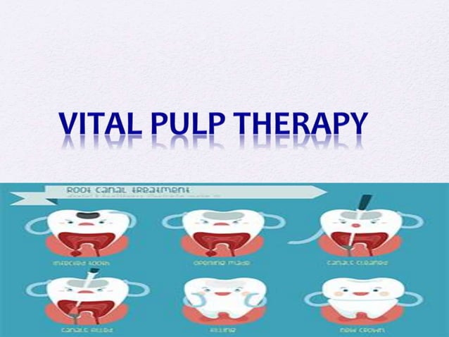 pulp therapy in young permanent tooth | PPTX | Dental Health | Diseases ...